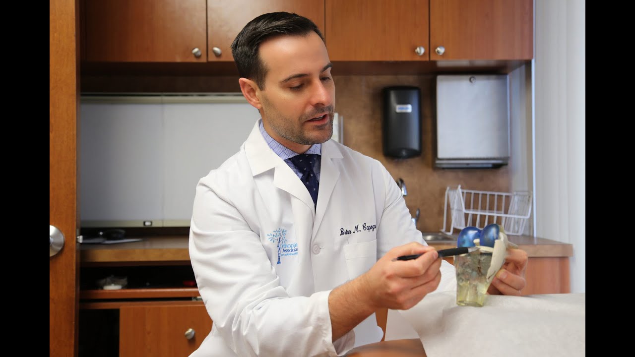 Dr. Brian Capogna, Orthopaedic Surgeon Shares Insights on Biceps ...